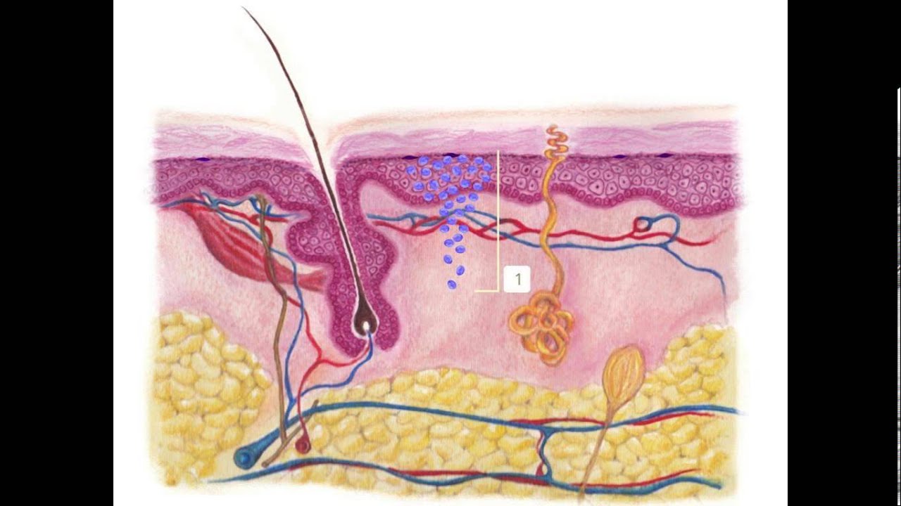 Understanding Your Melanoma Pathology Report