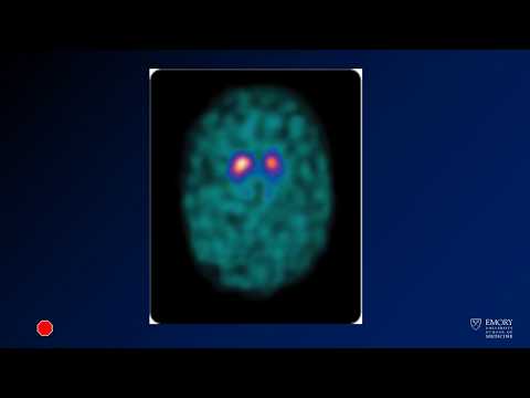Neuroradiology board review lecture 1 case 5