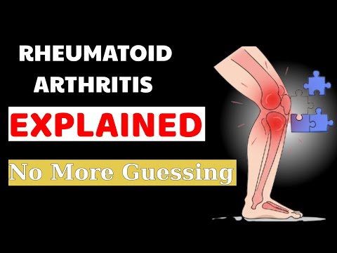 Rheumatoid Arthritis: Everything You Need to Know