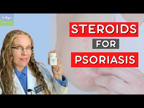 Steroids for Psoriasis