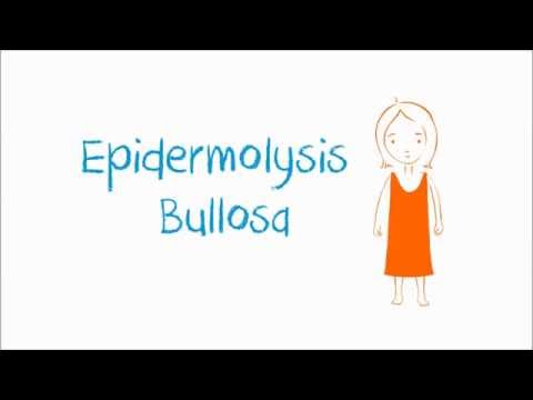 What is EB (epidermolysis bullosa)?