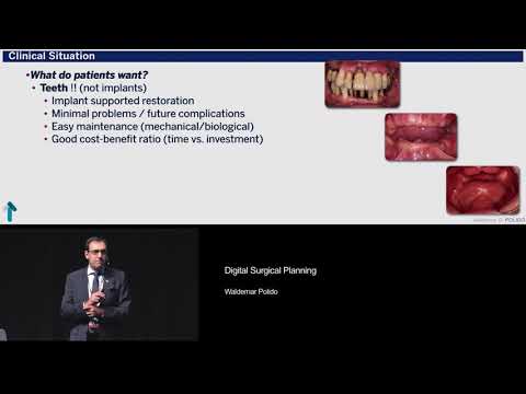 Digital Surgical Planning | Waldemar Polido