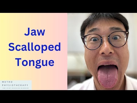 Jaw - Scalloped Tongue - A Major List of Why it Happens