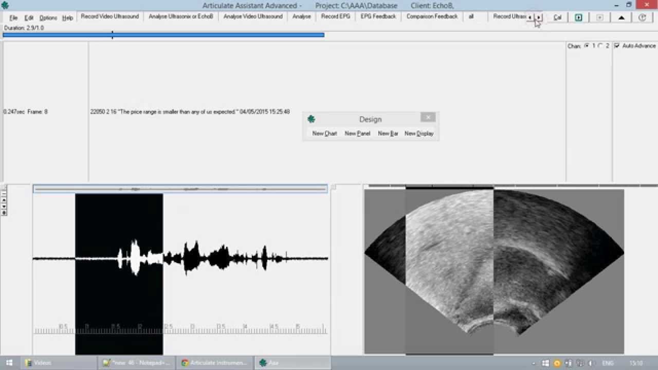Tutorial 10: Customizing the User Interface