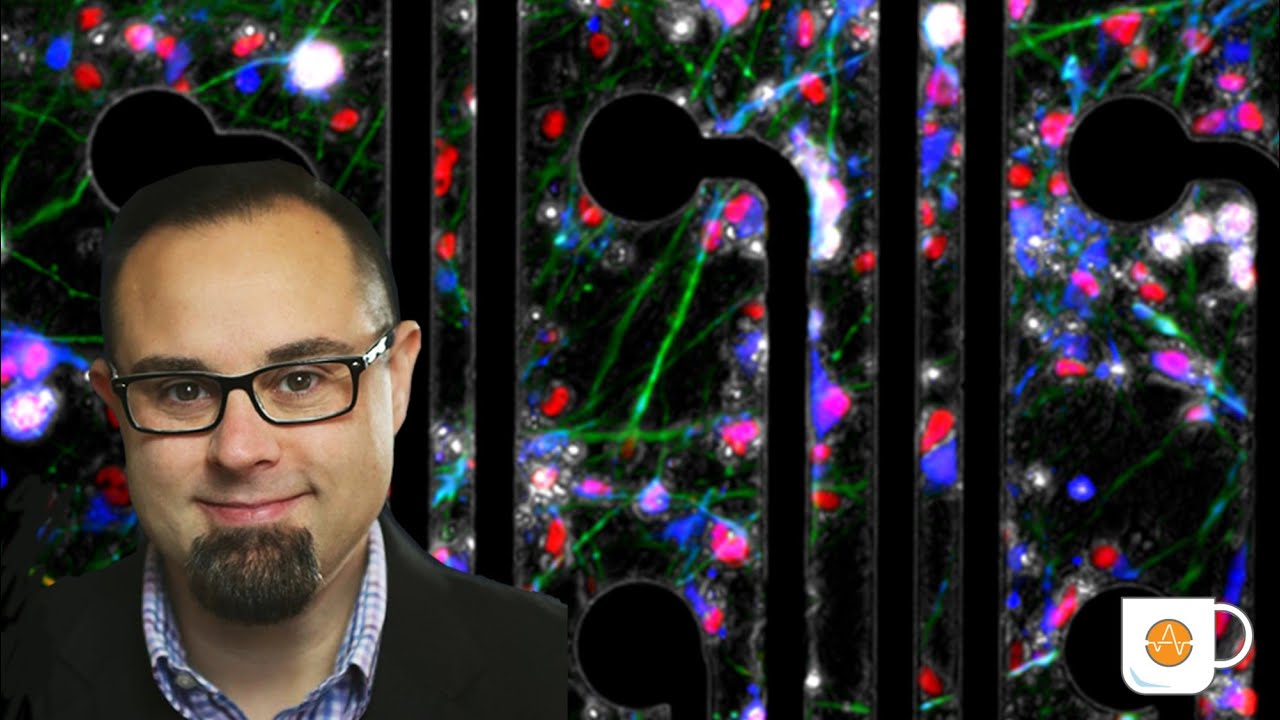 Autism study on the Maestro multiwell MEA system: Coffee Break Webinar