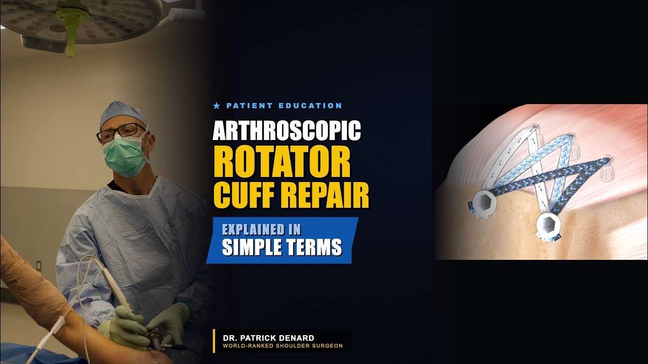 Arthroscopic Rotator Cuff Repair in Simple Terms