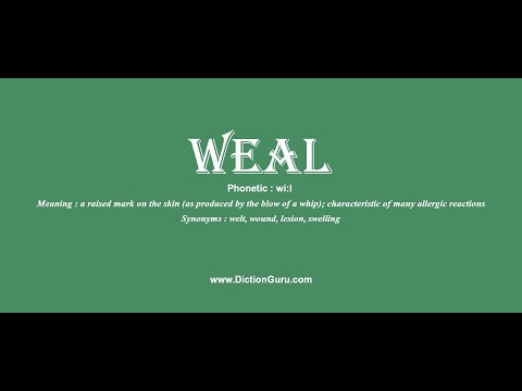 weal: Pronounce weal with Phonetic, Synonyms and Examples