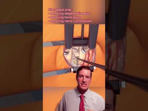 Same day neck surgery?
