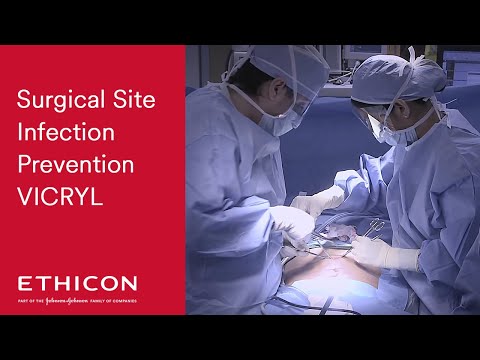 Ethicon Suture - Latest Price, Dealers & Retailers in India