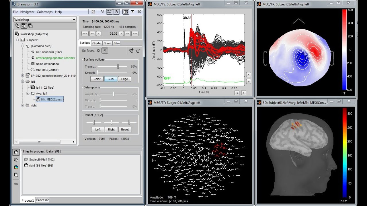 Brainstorm: Imaging neural activity at the speed of brain