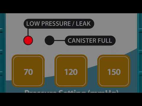 NPWT SVED Device Alarms