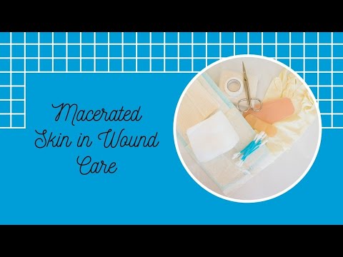 Macerated Skin in Wound Care