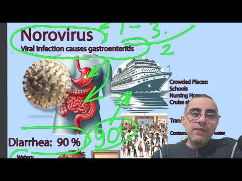 Norovirus Explained: Severe  Watery Diarrhea in Children