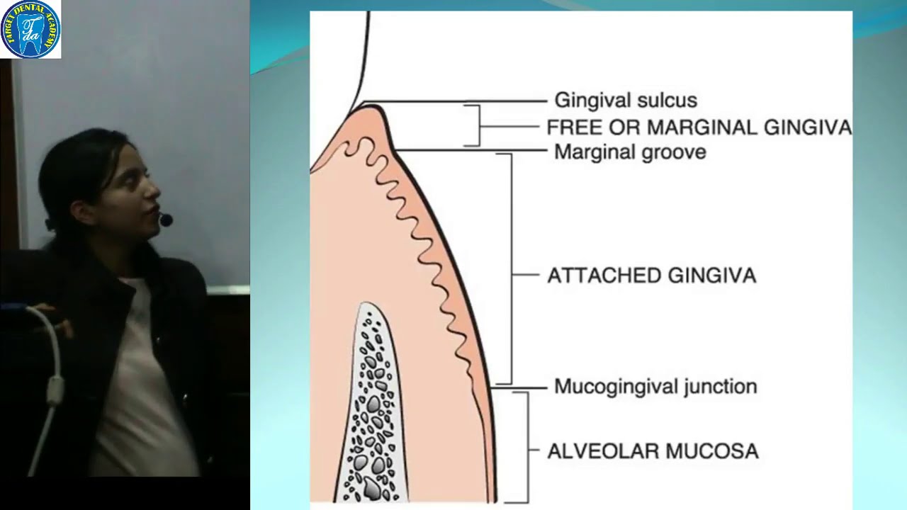 Periodontics 1- Normal Periodontium 1- Gingiva