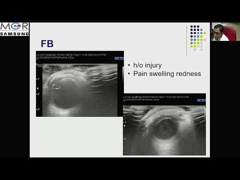 High-resolution ultrasound or B scan of orbit in various acute and chronic conditions.