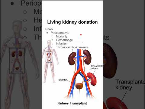 Living kidney donation