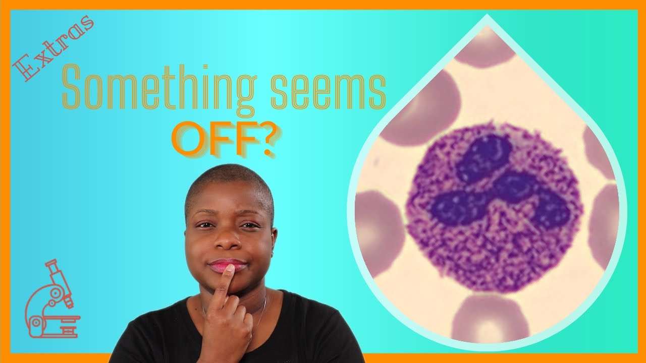 Identifying Alder-Reilly Anomaly | Heme Ed Extras