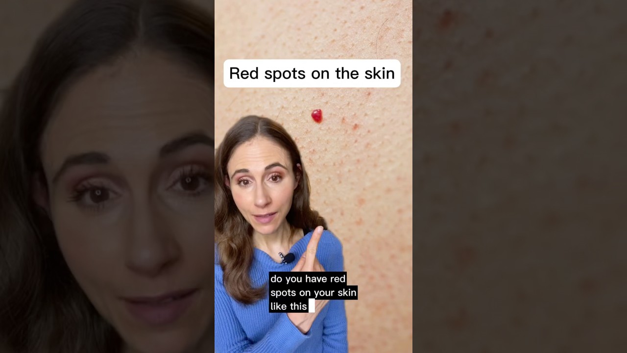 Red Spots On The Skin: What Could They Be? #dermatologist