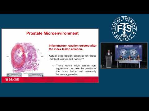 Critical Debate: Focal Therapy vs. Whole Gland Treatment for Prostate Cancer PGG 2/3