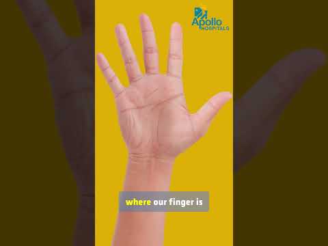 Understanding the Parietal Lobe: Key Brain Functions Explained | Dr. Sudhir Kumar | Apollo Hospitals