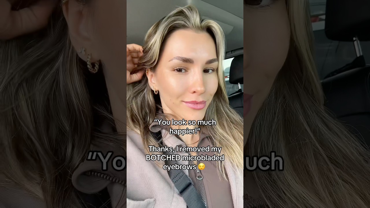 I FINALLY Removed My Botched Tattoo Eyebrows! 😌 #microbladedbrows #lasertattooremoval