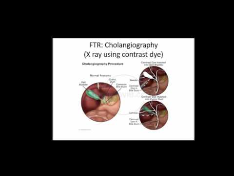 Chapter 4 Surgery Digestive System Part 2