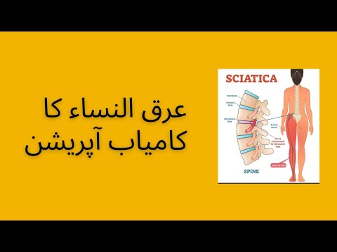 Interview of patient after Sciatica Surgery(عرق النساء). 3rd video.