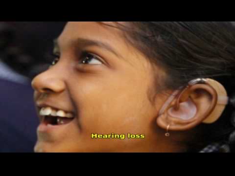 Sensory Disabilities Definition, Causes, Classification, Prevalence and Ch
