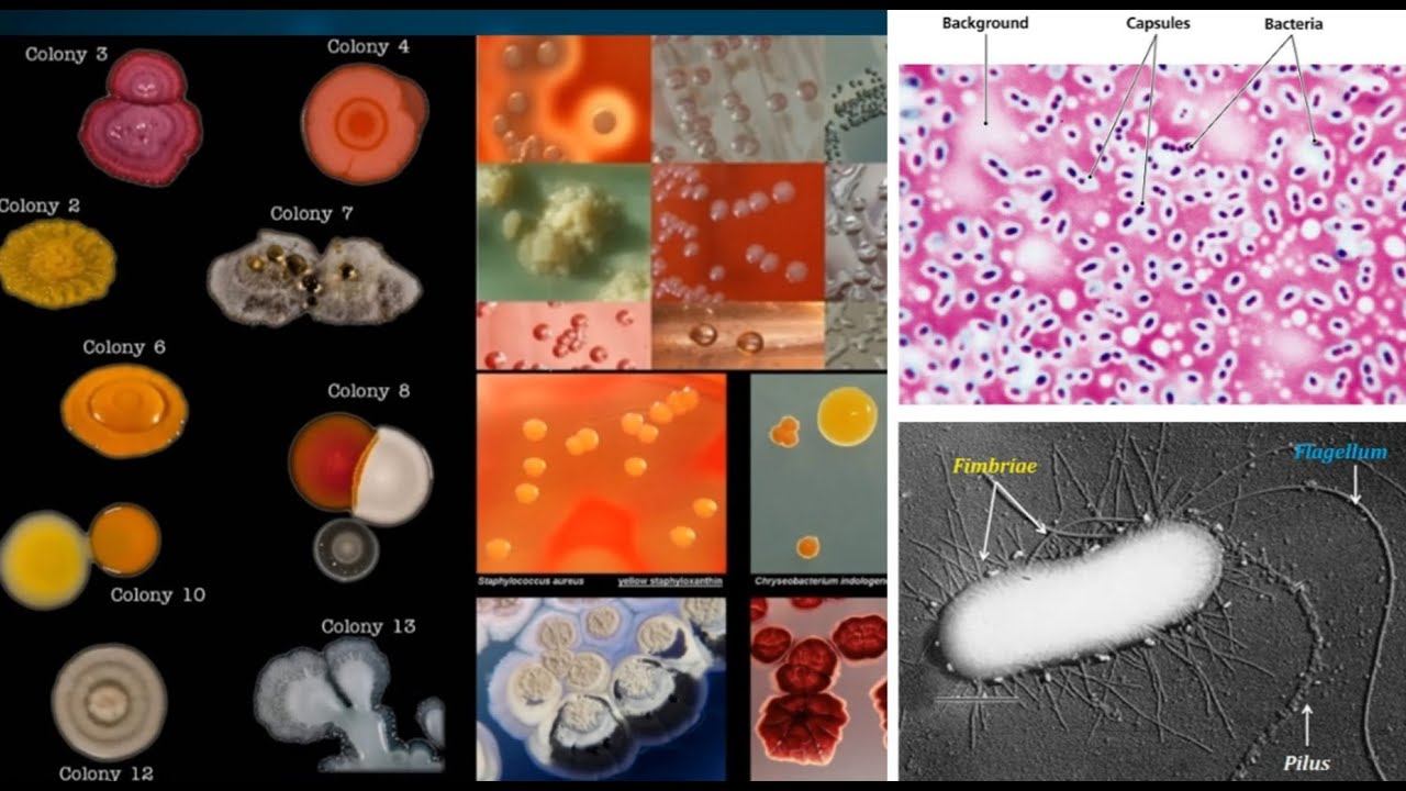 Sample Processing in Microbiology