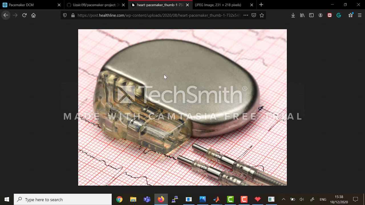 Pacemaker Project using Serial communication