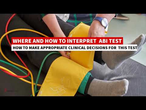 ABI Test in the management of people with chronic leg ulcers due to mixed arterial/venous