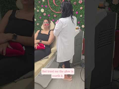 CO2 Fractional Laser: Real Skin Transformation in 1 Session! 🔥✨ #skincare