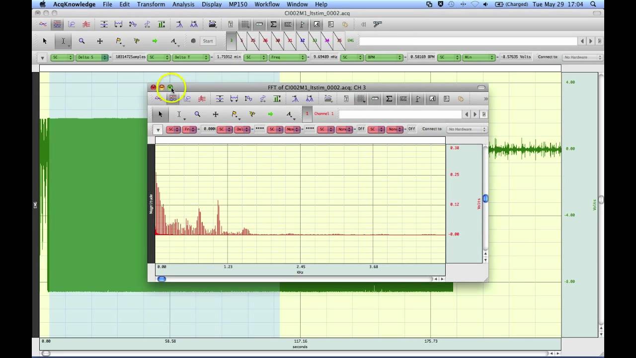 MRI - Cleaning Data - EMG example