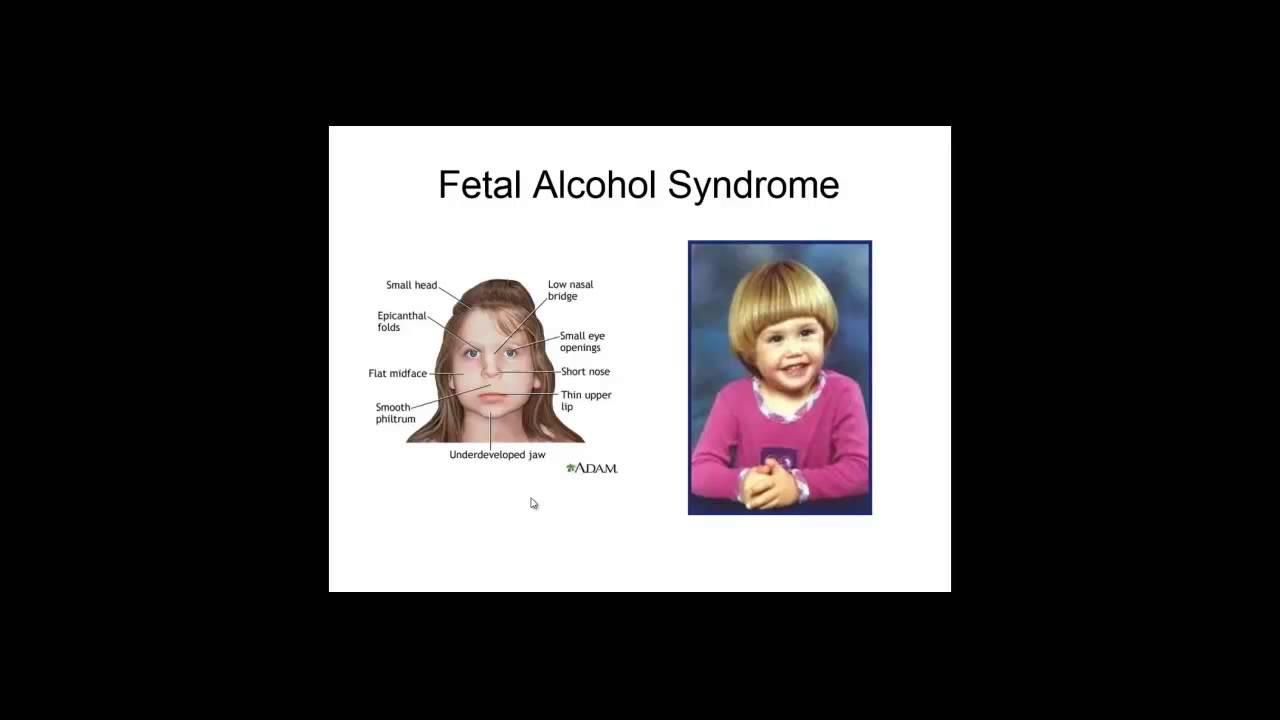 Pregnancy FA14