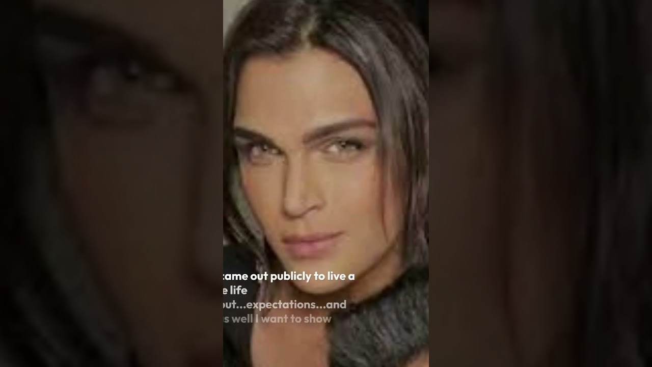 Transgender Designer Saisha shares her facial surgery#youtube #follow #viral #ytshorts #love #short