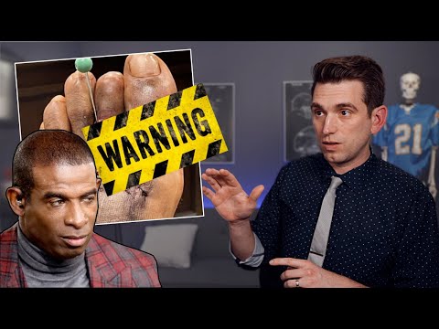 A Doctor Reacts to Deion Sanders Having Two Toes Amputated