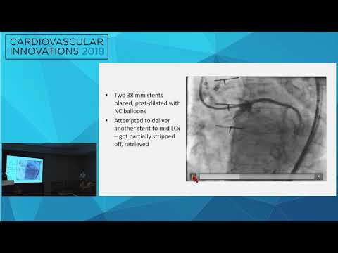 CVI2018 Coronary Challenging Case Competition: Semifinals 1 - Arslan Shaukat, MD
