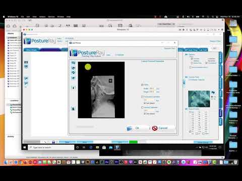 Dicom Receive Start to Finish