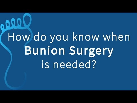 When is Bunion Surgery Recommended?