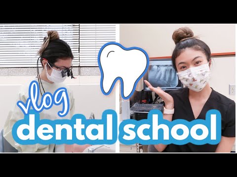 eye surgery, bridge comp, molar endo // LauraSmiles