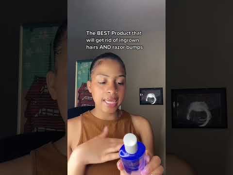 HOW TO GET RID OF INGROWN HAIRS & RAZOR BUMPS FOR GOOD!