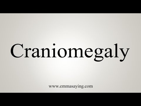 How To Say Craniomegaly