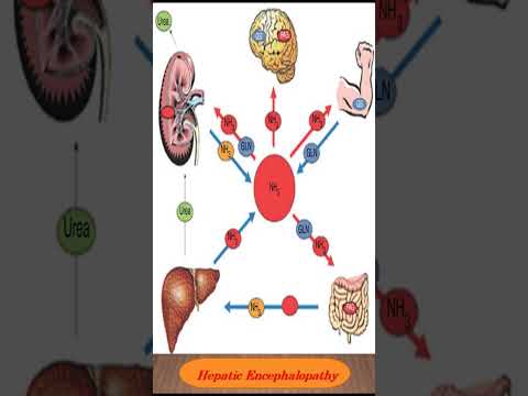 Hepatic Encephalopathy Treatment | Which Medicine Use In Hepatic Encephalopathy Disease