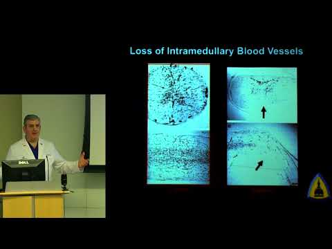 "Novel Concepts in Spinal Cord Pathophysiology" - Nicholas Theodore, MD