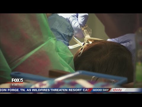 Sealing children's teeth can prevent cavities