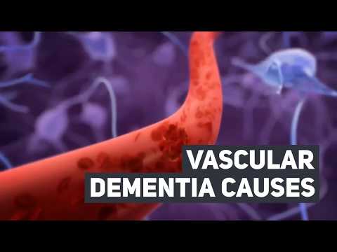 Vascular Dementia Causes