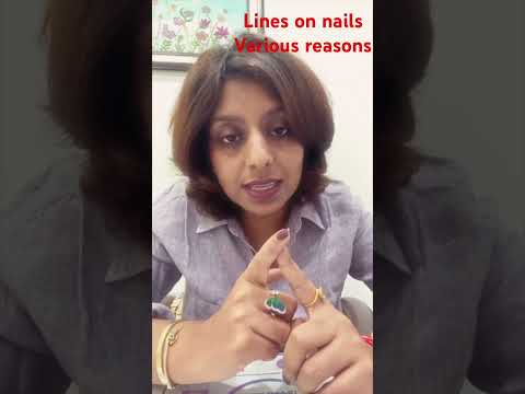 Lines on nails #yellow nails # brittle nails# pits on nails-Dr shikha Garg