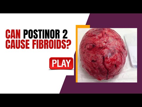 Can Postinor 2 Cause Fibroids? | Myth Busted!