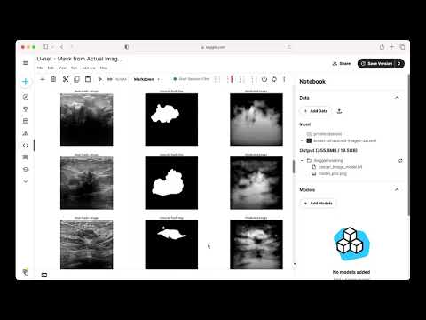 A Kaggle session on medical image segmentation by a U-Net