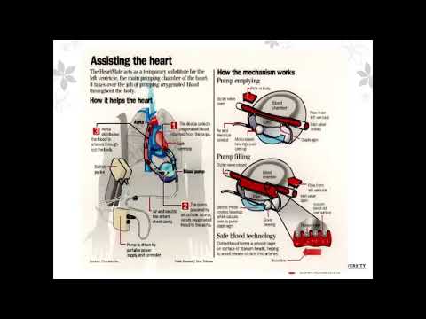 Can We Cure Dilated Cardiomyopathy? by Dr Binkley